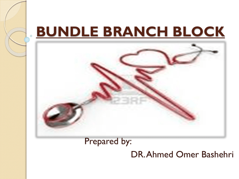 BUNDLE BRANCH BLOCK