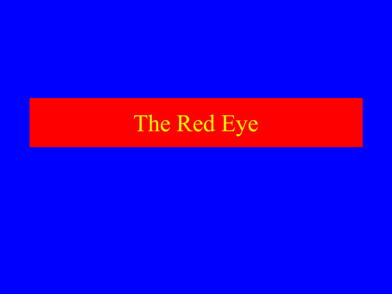 Red Eye Powerpoint