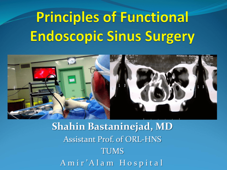 Primary Sinus Surgery