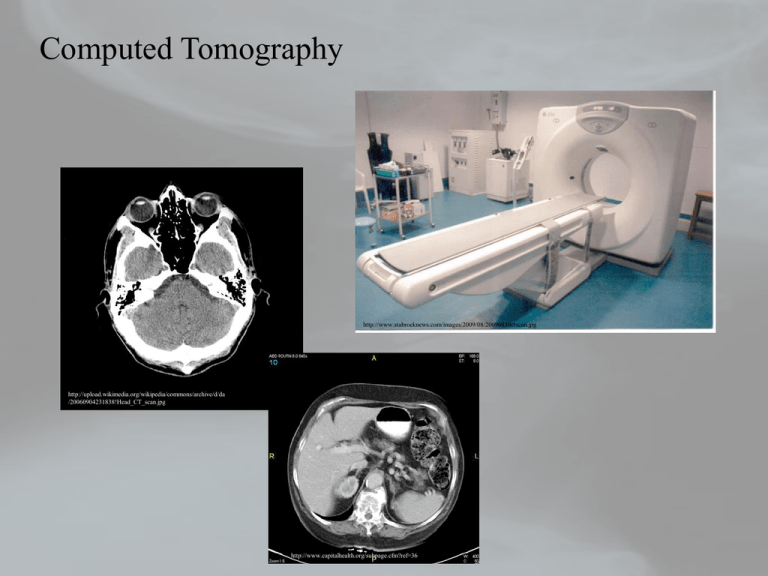 Computed Tomography
