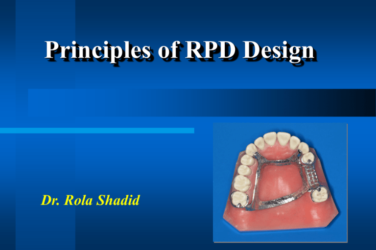RPD Design Principles: A Dental Overview