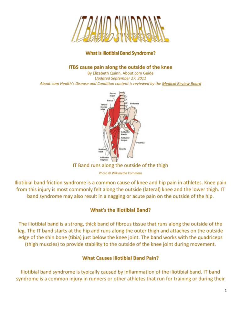 What Is Iliotibial Band Syndrome? ITBS cause pain along the