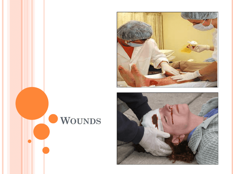 Definition Of Wound Definition Of Wound