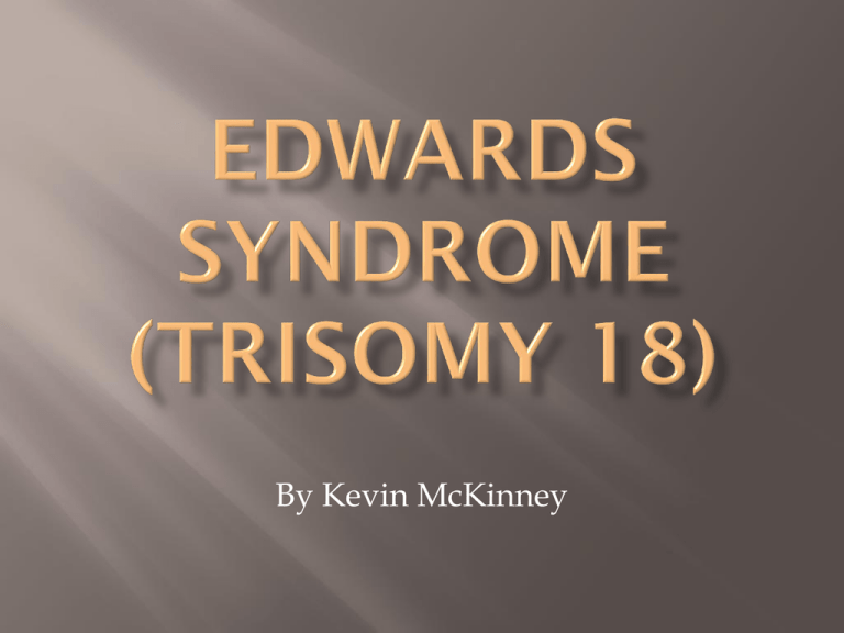 Edwards Syndrome (Trisomy 18) Presentation