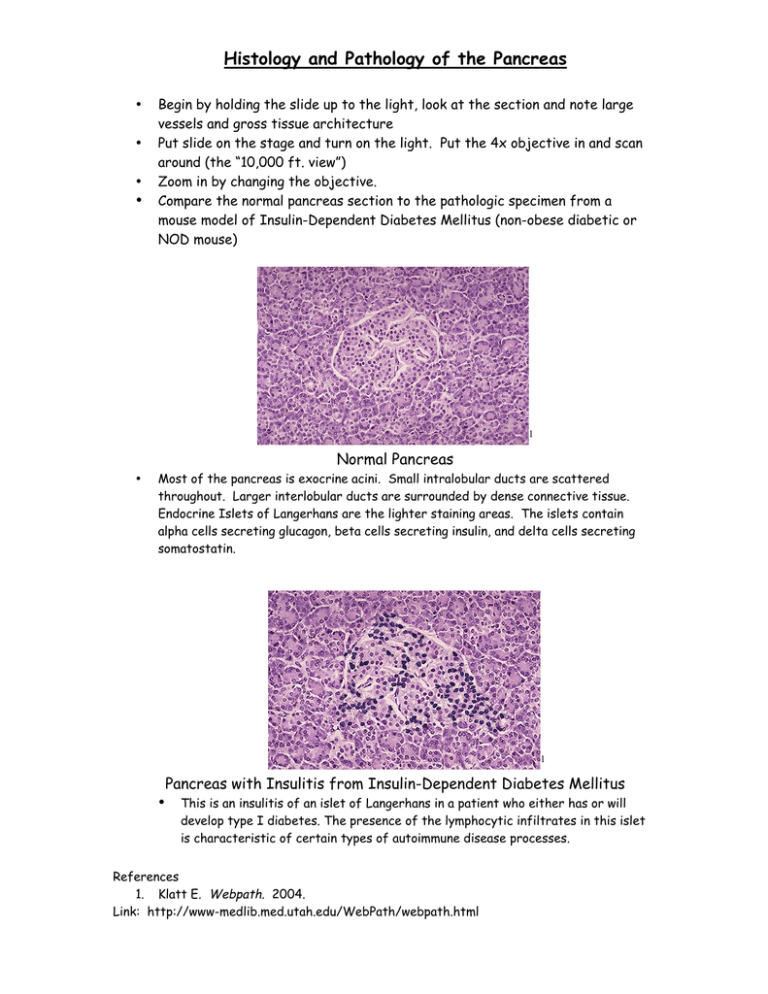 Pancreas Histology & Pathology: Diabetes Insulitis