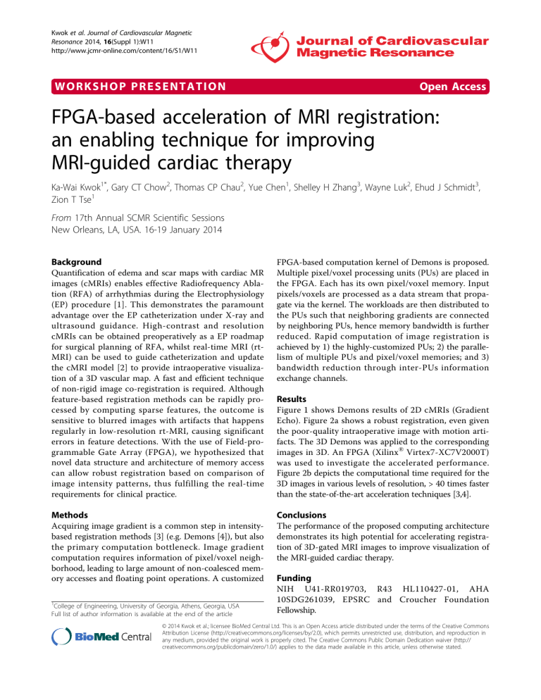 Fpga Based Acceleration Of Mri Registration An Enabling Technique For Improving 