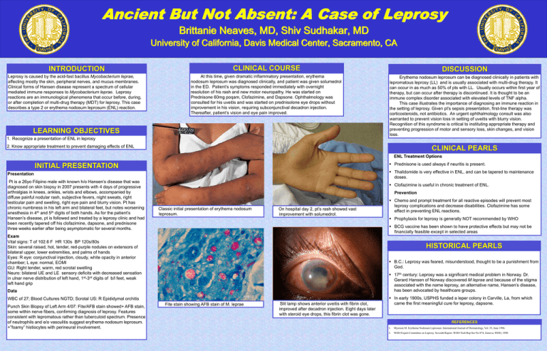 Leprosy Case Study: Erythema Nodosum Leprosum (ENL)