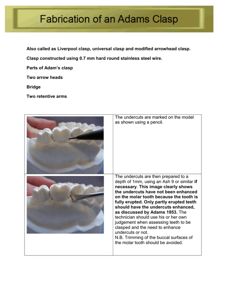 Adams Clasp Fabrication: A Step-by-Step Guide