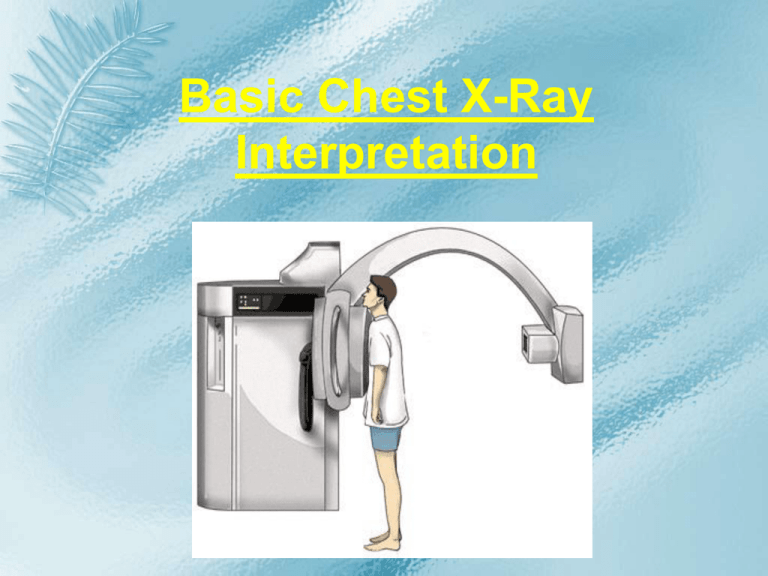 Basic Chest X-Ray Interpretation.ppt