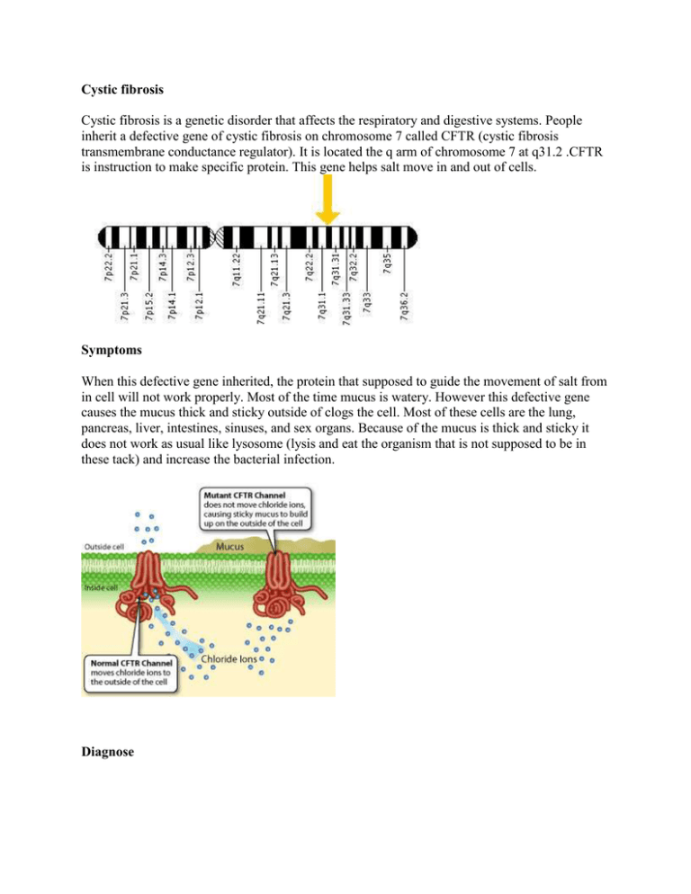 Cystic fibrosis