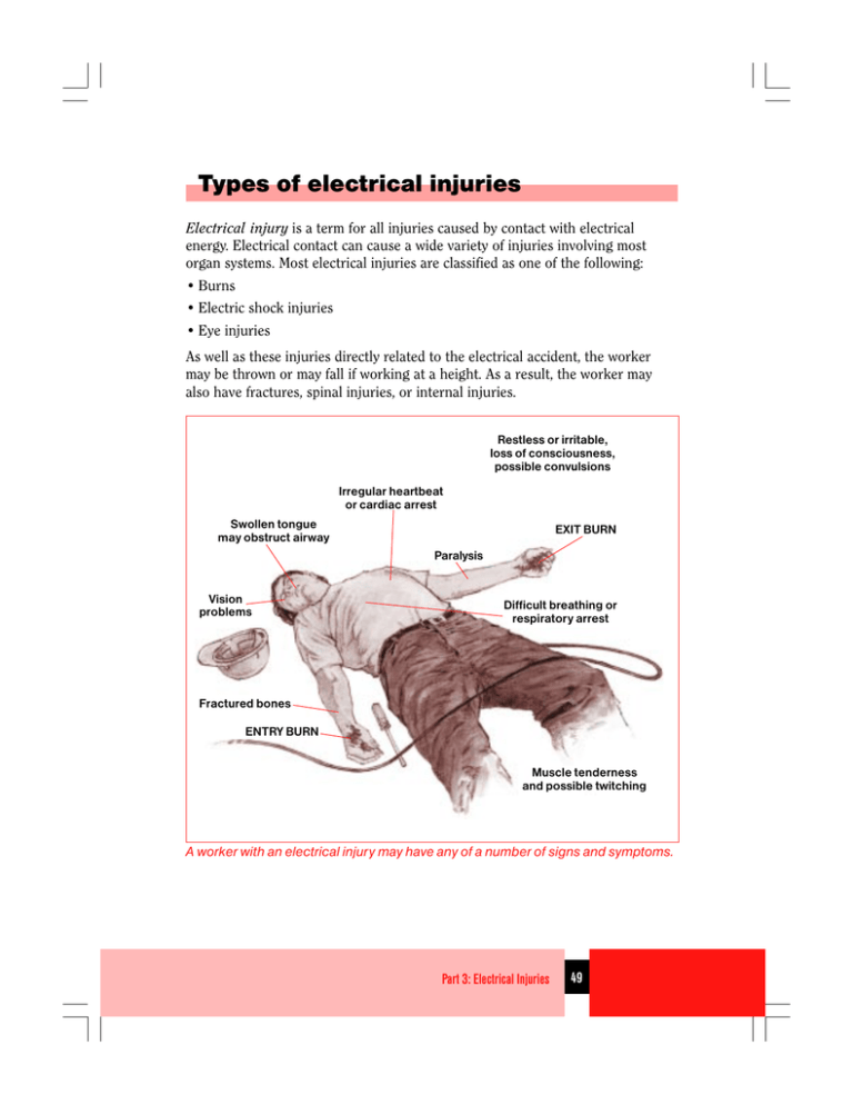 Electrical Injuries: Types, Symptoms & First Aid