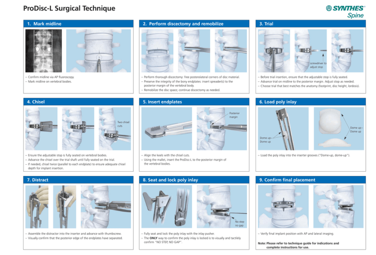 ProDisc-L Surgical Technique Guide