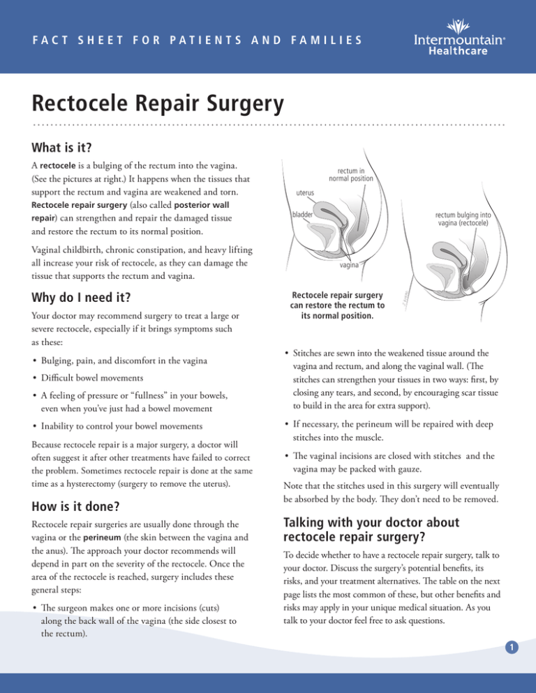 Rectocele Repair Surgery: Patient Fact Sheet