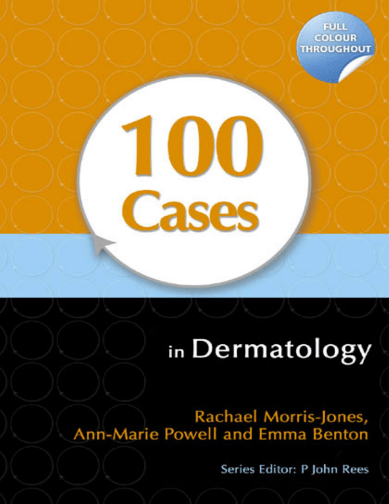 100 Dermatology Case Studies for Medical Professionals