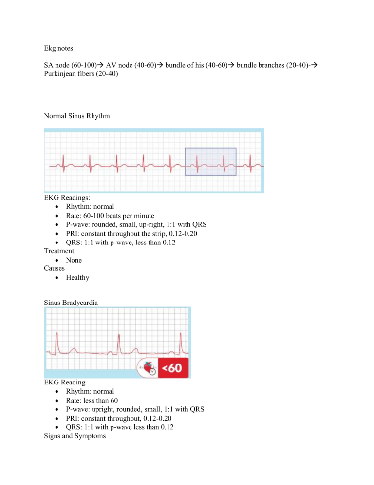 Different EKG Readings