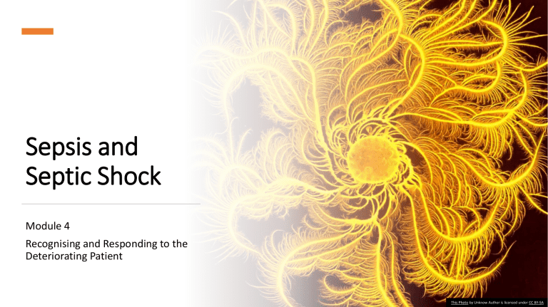 Sepsis and Septic Shock presentation 2021