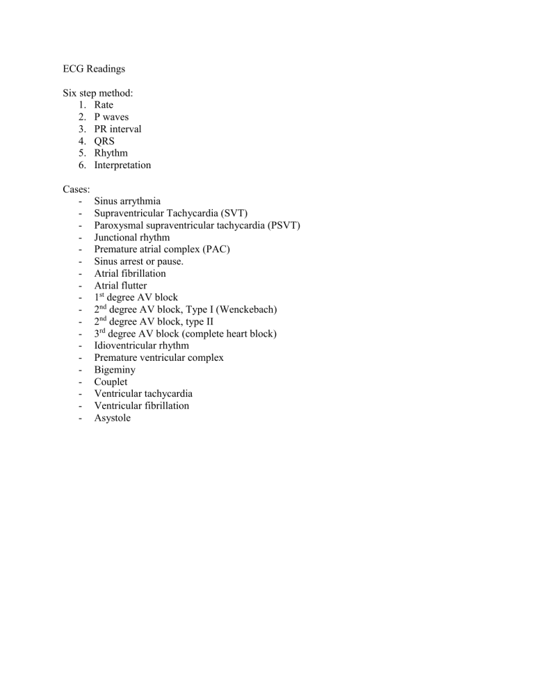 ECG Reading Guide: 6-Step Method & Cardiac Rhythms